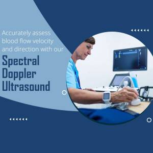 9000+ 3d 4d usg color doppler Images & Videos | 3d 4d usg color doppler ...